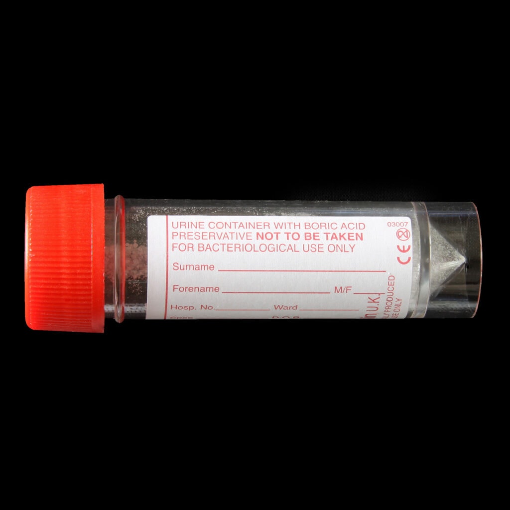 30ml Urine Sample Container With Boric Acid Preservative